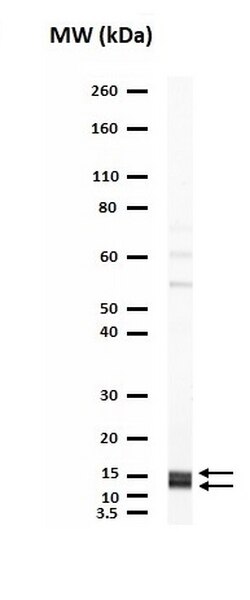 Anti-LC3-I/II Antibody | ABC929